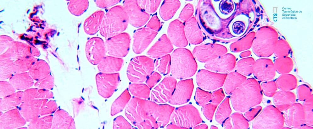 Enfermedad de Triquinosis | Centro Tecnológico de Seguridad Alimentaria